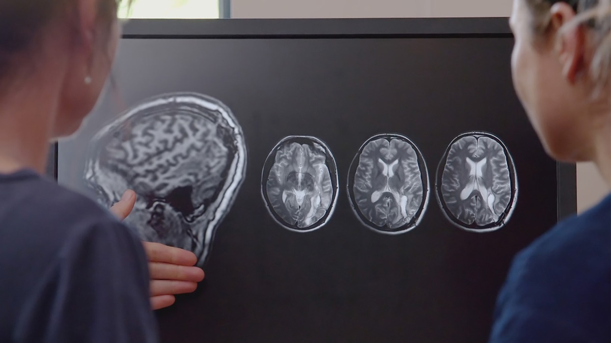 Can You Fix a Brain Like Mine? - Apple TV