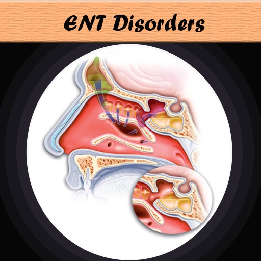 ENT Disorders by Dilip J Bhagora