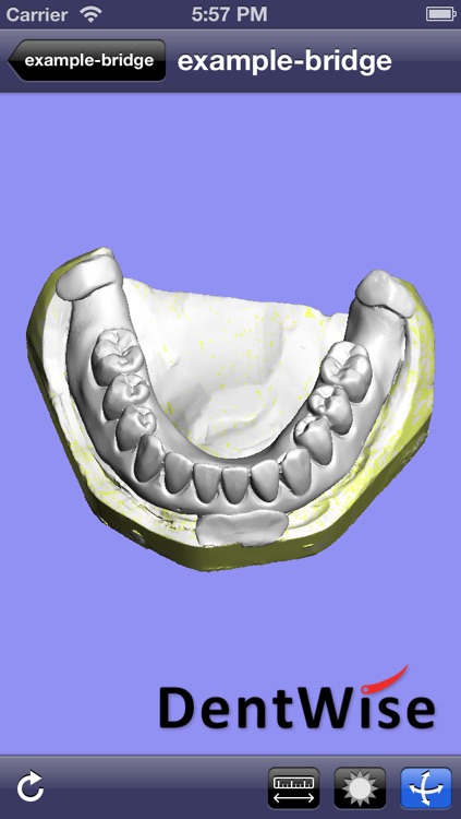 DentWise Viewer by Visual Computing Lab - ISTI - CNR