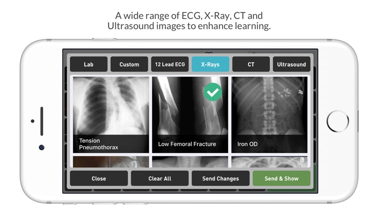 TruMonitor - TruVent by Trucorp Ltd