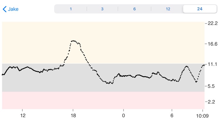 Dexcom Follow mmol/L DXCM1 by Dexcom