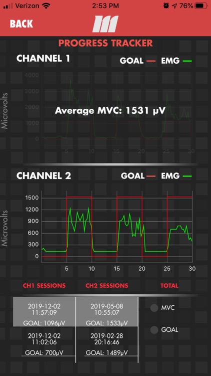 mTrigger™ Biofeedback by mTrigger