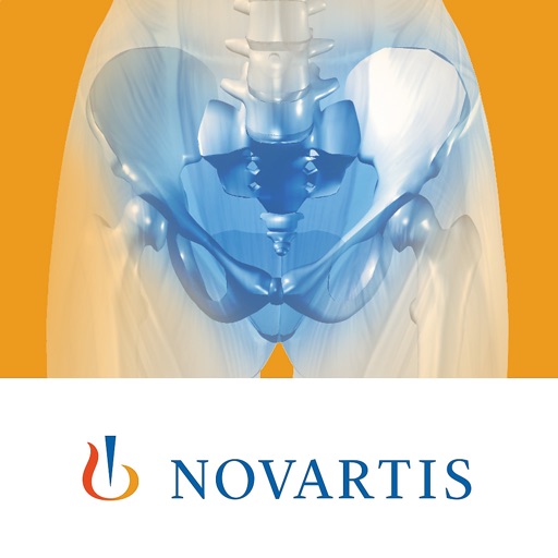 axSpA Identification Tool by Novartis Pharmaceuticals Corporation