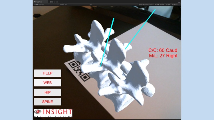 Insight Medical AR by Insight Medical Systems, Inc.