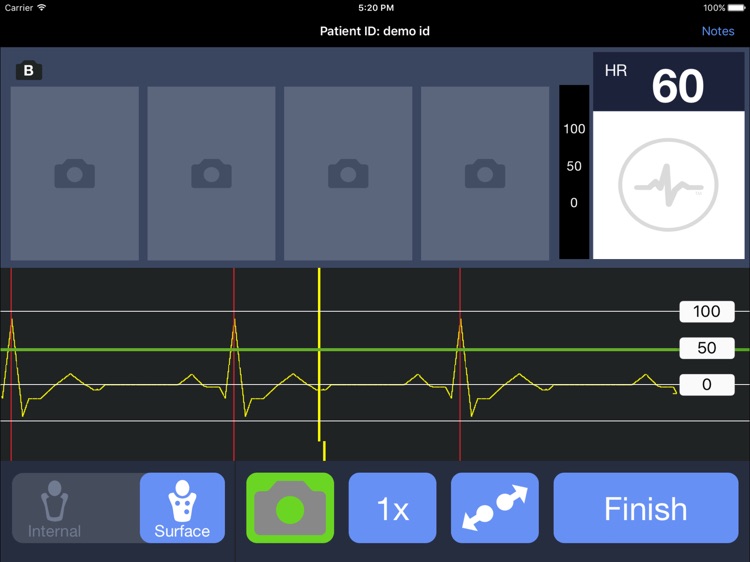 C3 Wave™ Canada by Medical Components, Inc.